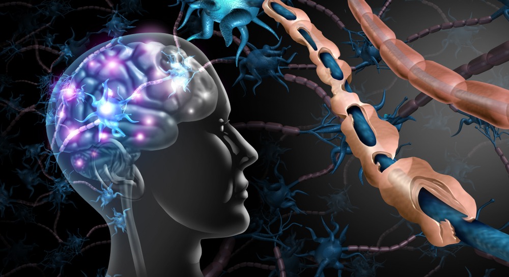 Multiple Sclerosi Lawyer in Pittsburgh | Free Case Evaluation